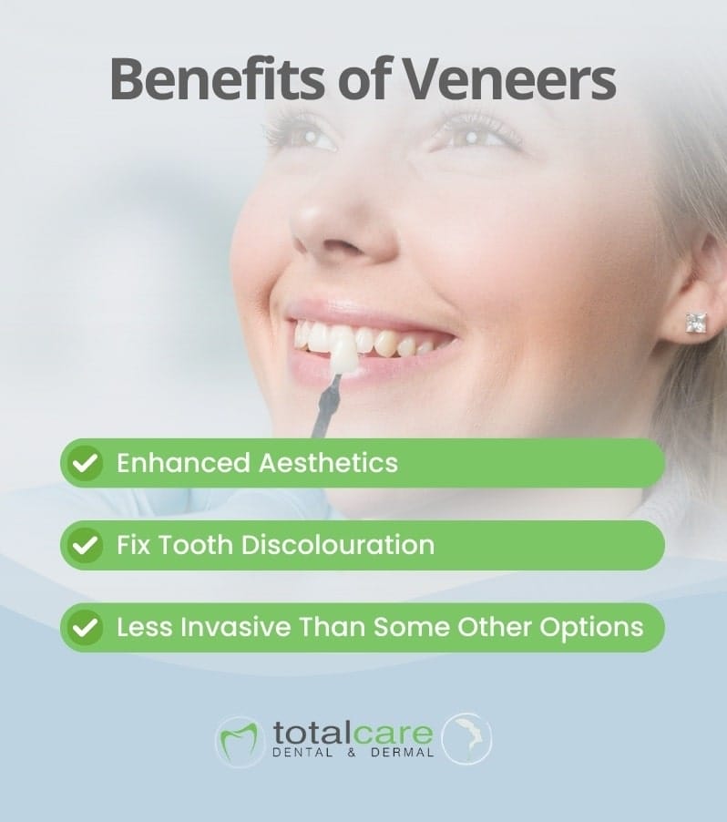 What are Veneers? Benefits, Procedure, Costs, and Results